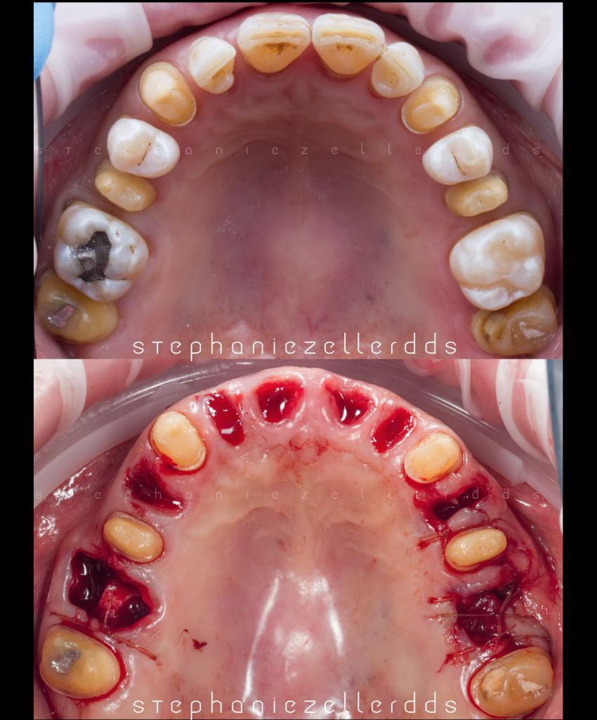 In defense of dental Instagram - Dental Hacks