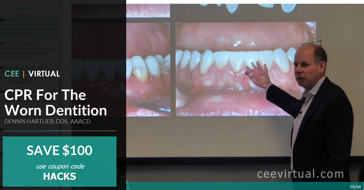 Seeing the Big Picture with Dr. Gregg Kinzer (DHP217) - Dental Hacks