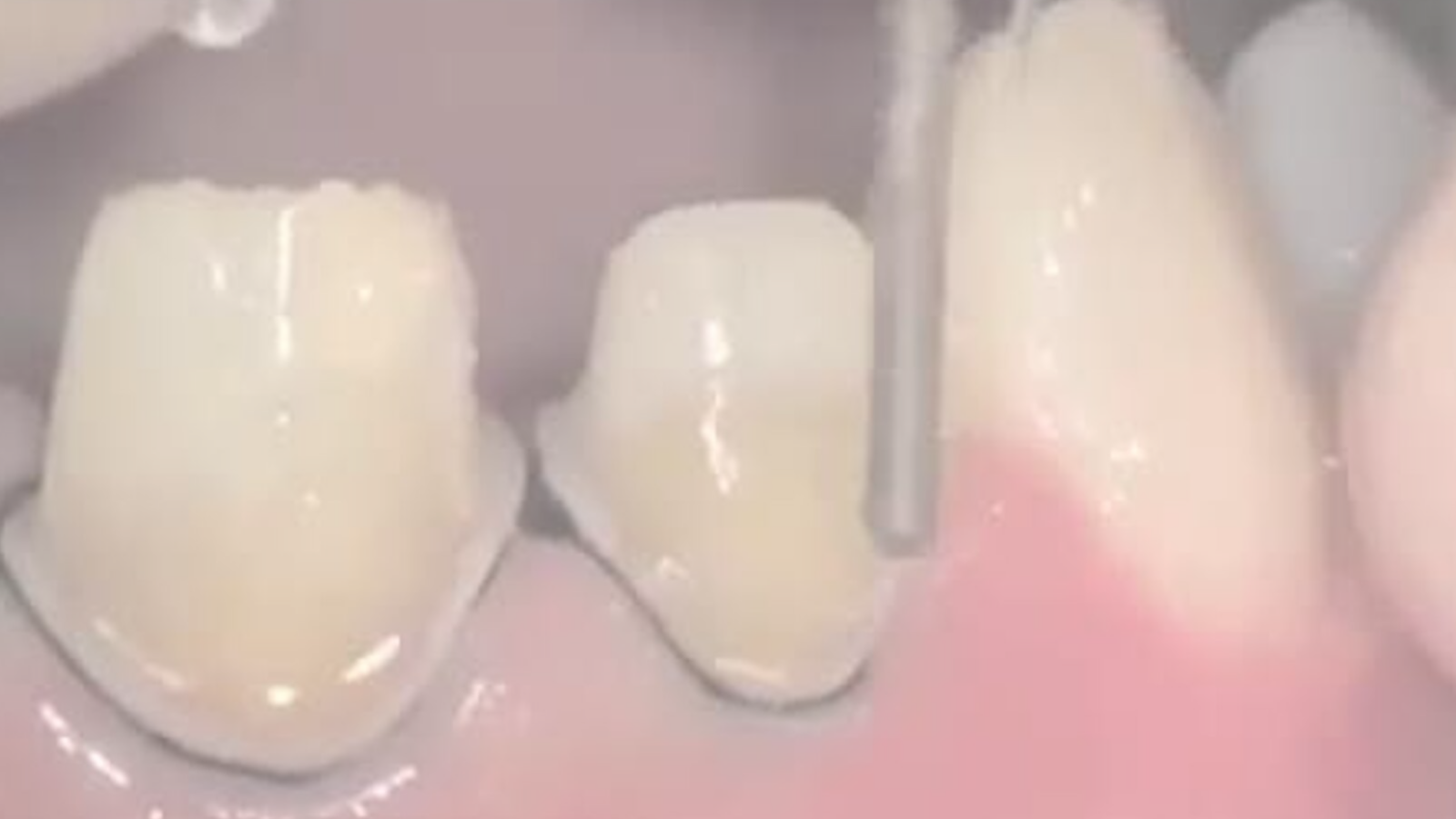 Dr. Nazariy Mykhaylyuk in Microscopic Detail (DHP259) - Dental Hacks