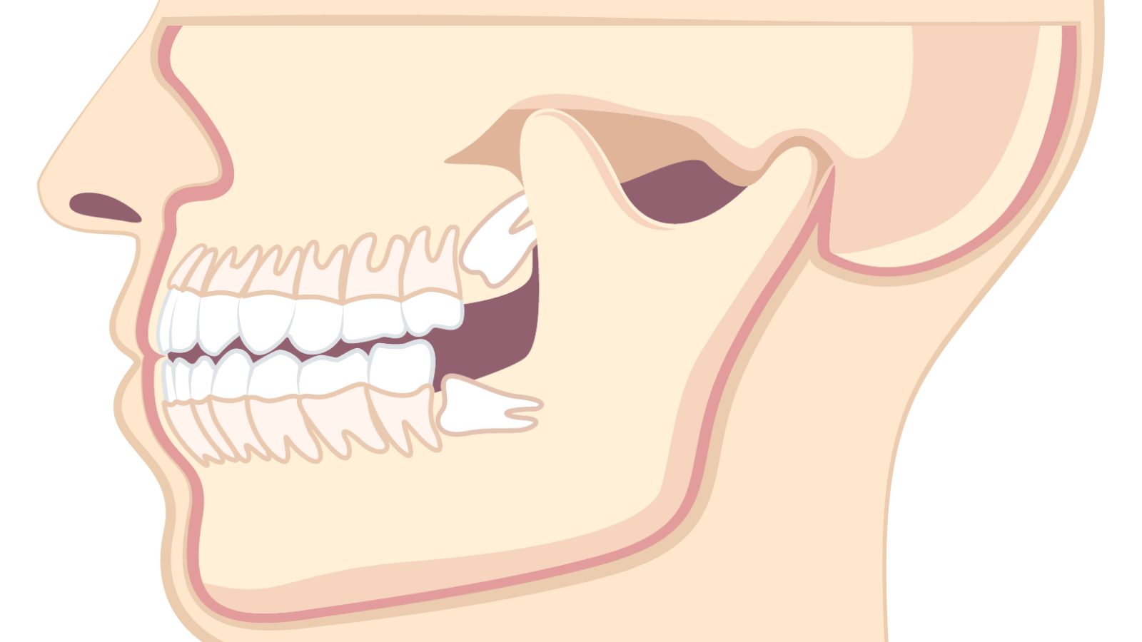 Good Joints and Bad Joints with Dr. Jim McKee (DHP264) - Dental Hacks